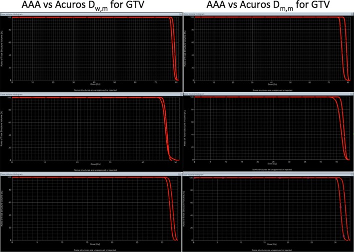 Clinical implementation and evaluation of the Acuros dose calculation algorithm - PMC