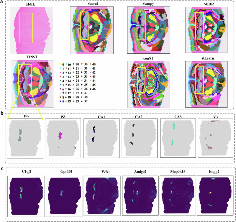 A composite scaling network of EfficientNet for improving spatial domain identification ...