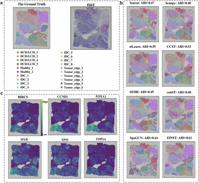 A composite scaling network of EfficientNet for improving spatial domain identification ...