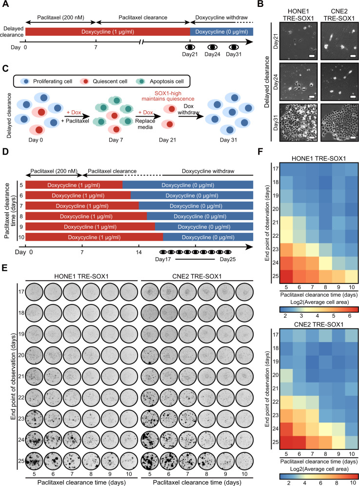SOX1 acts as a tumor hypnotist rendering nasopharyngeal carcinoma cells refractory to ...