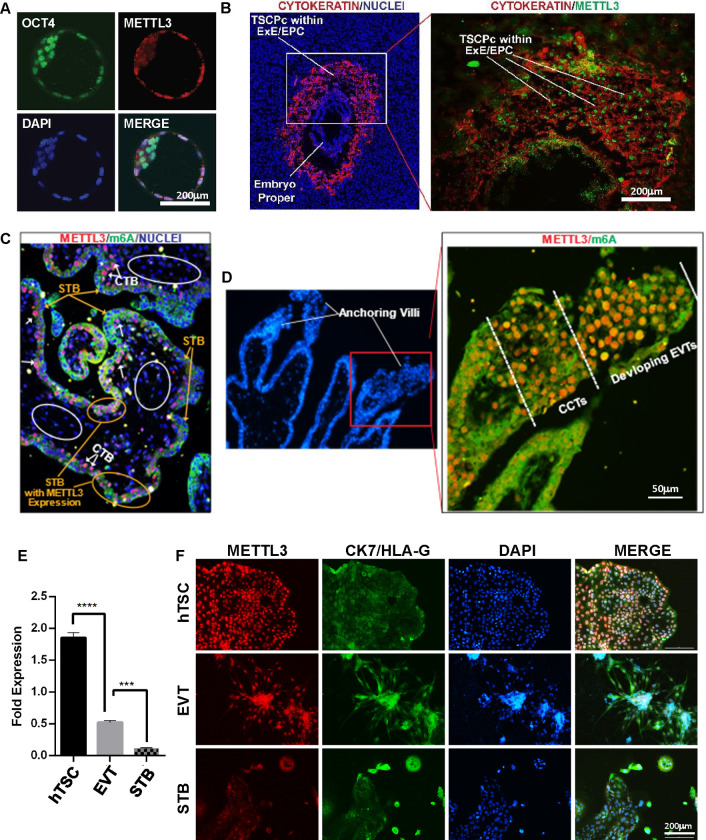 METTL3 shapes m6A epitranscriptomic landscape for successful human placentation - PMC