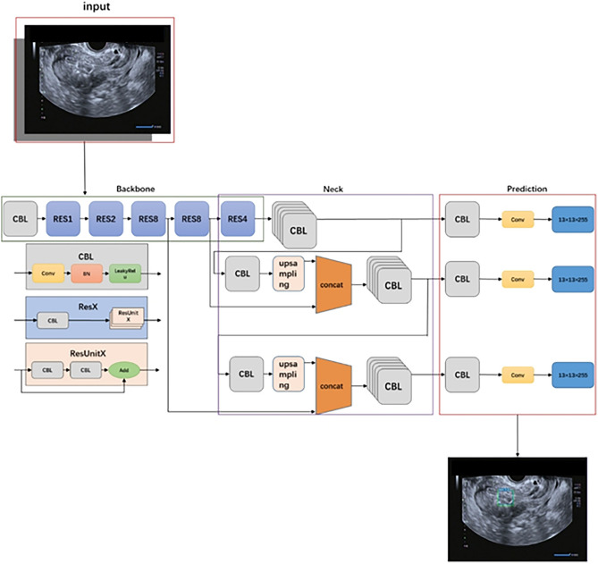 Artificial intelligence-aided method to detect uterine fibroids in ultrasound images: a ...