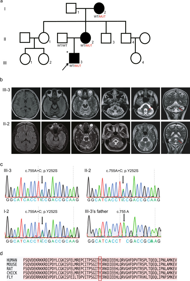 Clinical and functional characterization of a novel STUB1 mutation in a Chinese spinocerebellar ...