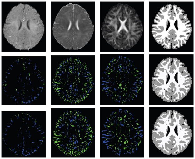Deep Convolutional Neural Networks for Multi-Modality Isointense Infant Brain Image Segmentation ...