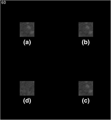 A simple method for low-contrast detectability, image quality and dose optimisation with CT ...