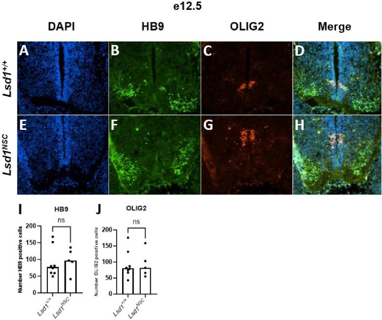 LSD1/KDM1A is essential for neural stem cell differentiation in mice - PMC LSD1/KDM1A is essential for neural stem cell differentiation in mice - PMC