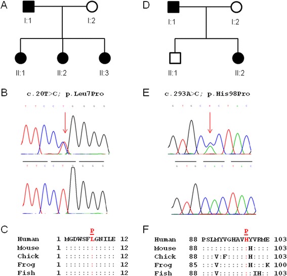 Exome sequencing identifies novel and recurrent mutations in GJA8 and CRYGD associated with ...