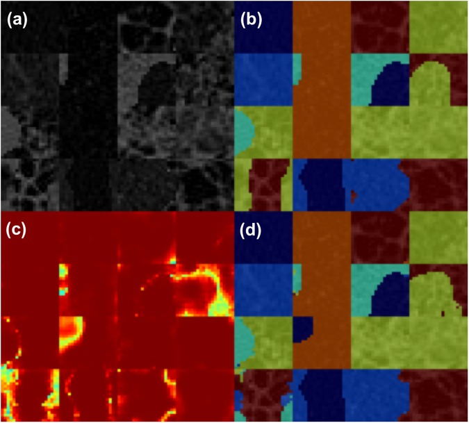 A Perlin Noise-Based Augmentation Strategy for Deep Learning with Small Data Samples of HRCT ...