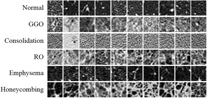 A Perlin Noise-Based Augmentation Strategy for Deep Learning with Small Data Samples of HRCT ...