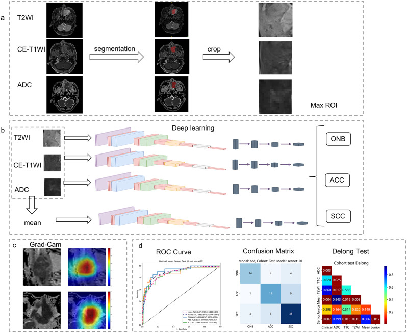 Deep learning models for differentiating three sinonasal malignancies ...