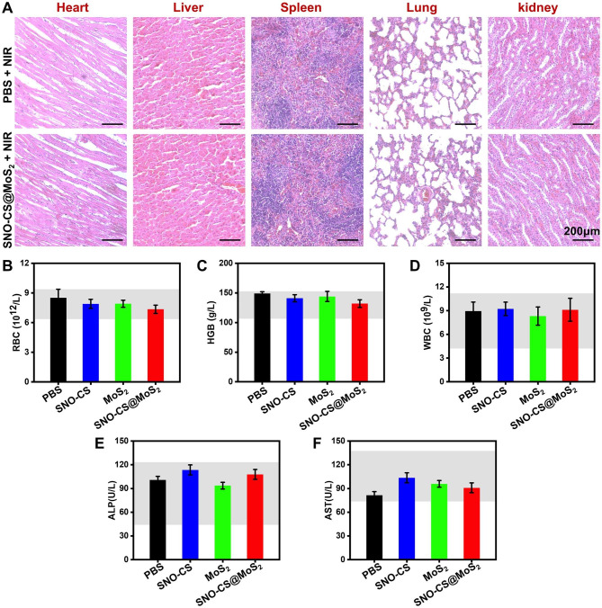 Functionalized MoS2-nanosheets with NIR-Triggered nitric oxide delivery and photothermal ...