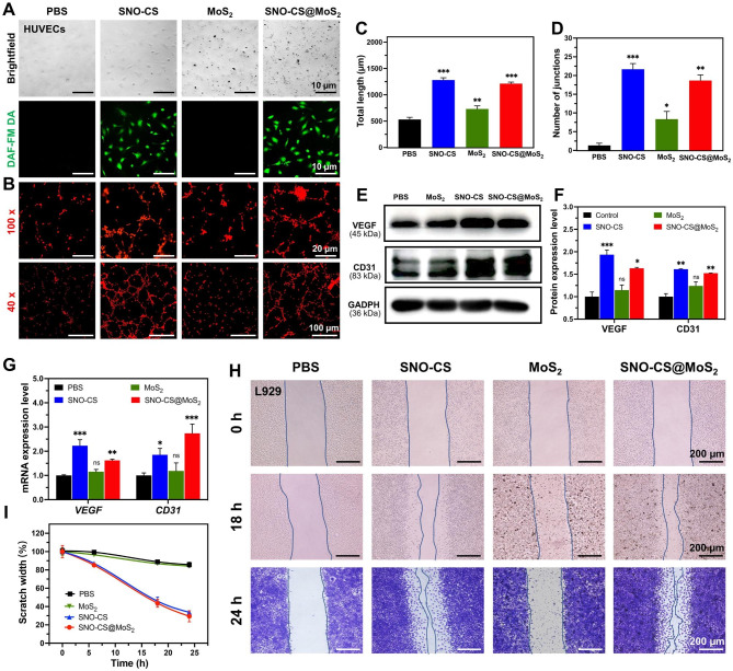 Functionalized MoS2-nanosheets with NIR-Triggered nitric oxide delivery and photothermal ...