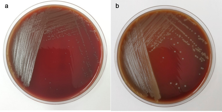 Vagococcus fluvialis isolation from the urine of a bladder cancer patient: a case report - PMC