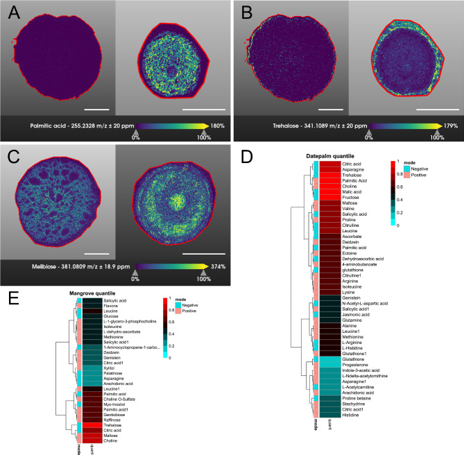 Microscopy and spatial-metabolomics identify tissue-specific metabolic pathways uncovering ...