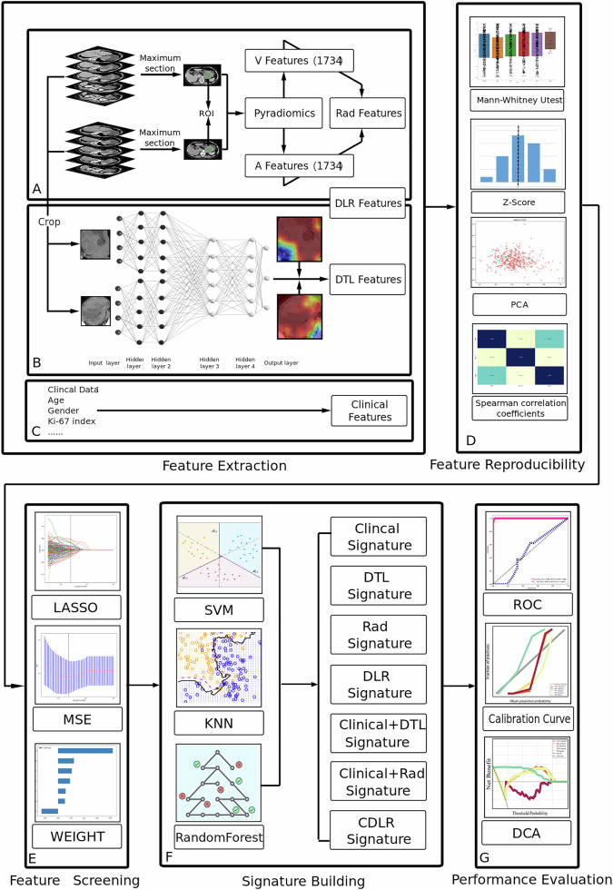 A machine learning model integrating clinical-radiomics-deep learning features accurately ...