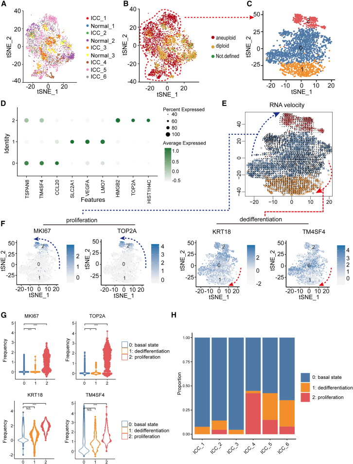 Multiple-omics analysis reveals a dedifferentiation-immune loop in ...