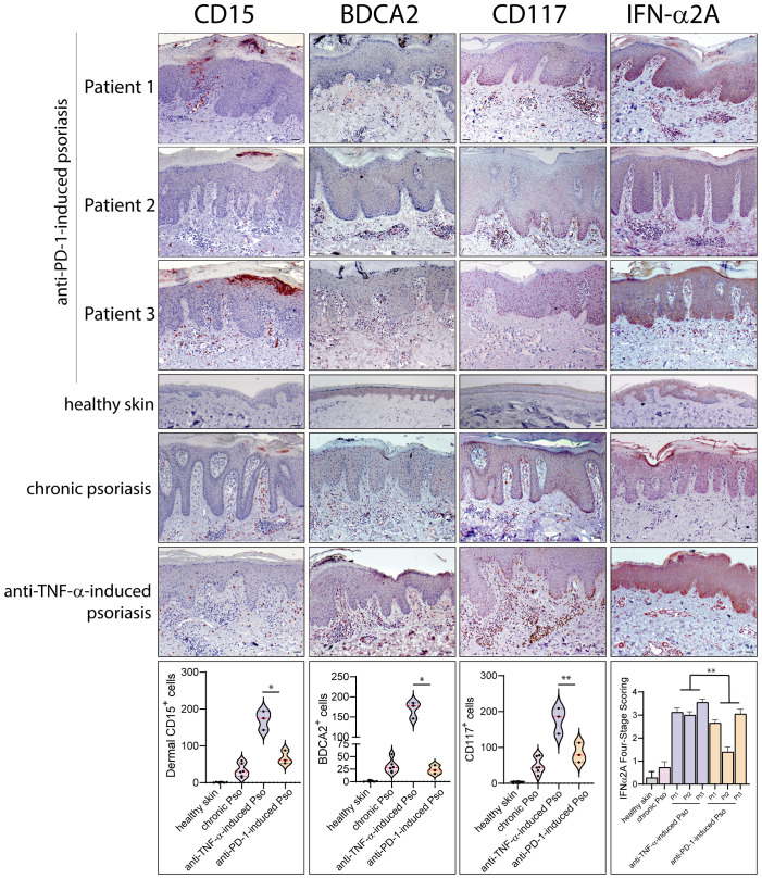 Identification of immunological patterns characterizing immune-related ... Identification of immunological patterns characterizing immune-related ...