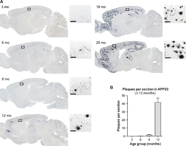Increased Csf Aβ During The Very Early Phase Of Cerebral Aβ Deposition