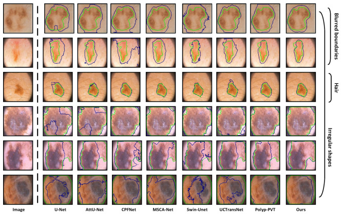 MASDF-Net: A Multi-Attention Codec Network with Selective and Dynamic Fusion for Skin Lesion ...
