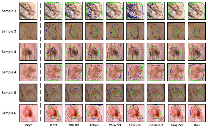 MASDF-Net: A Multi-Attention Codec Network with Selective and Dynamic Fusion for Skin Lesion ...
