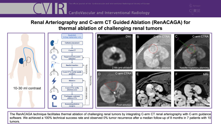 Renal Arteriography and C-arm CT-Guided Ablation (RenACAGA) for Thermal Ablation of Challenging ...