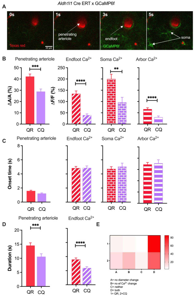 Modulatory Effects of Noradrenergic and Serotonergic Signaling Pathway on Neurovascular Coupling ...