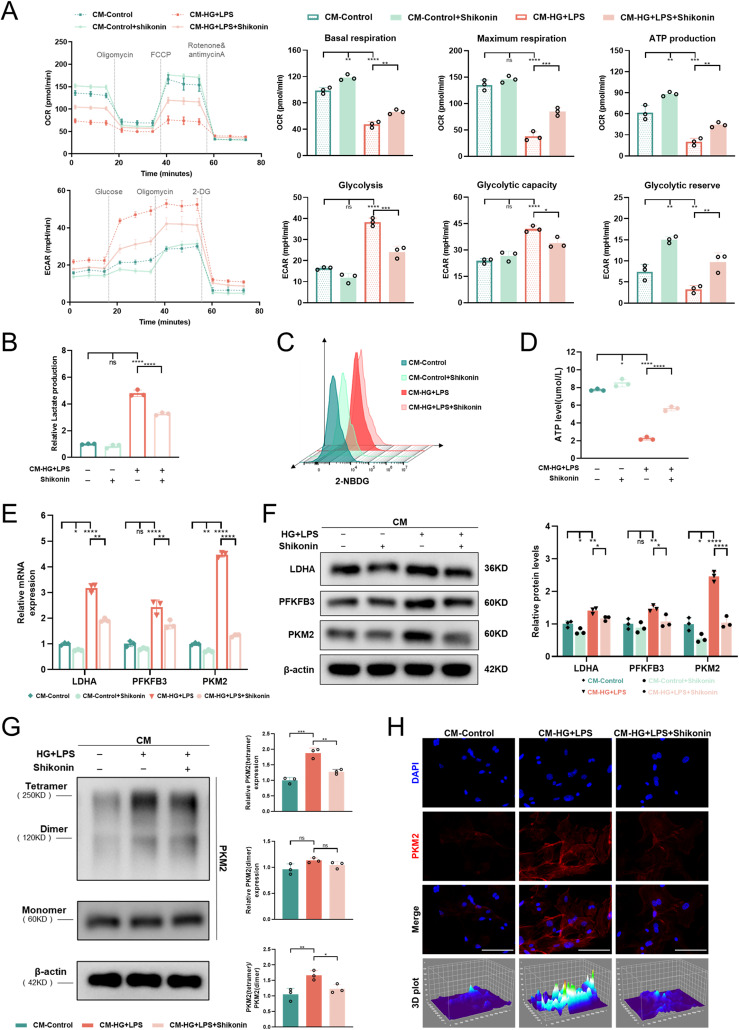 The role of PKM2-mediated metabolic reprogramming in the osteogenic differentiation of BMSCs ...