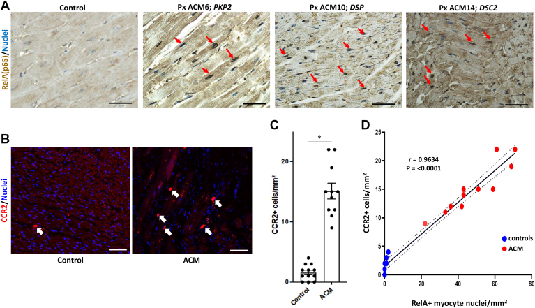 Innate Immune Signaling In Hearts And Buccal Mucosa Cells Of Patients With Arrhythmogenic