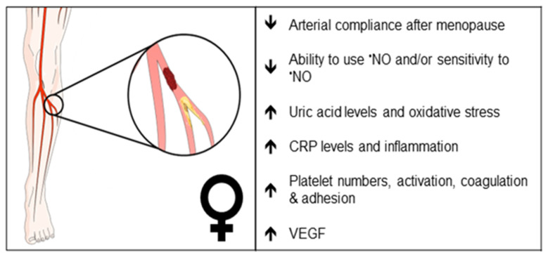 Sex Endothelial Cell Functions And Peripheral Artery Disease Pmc