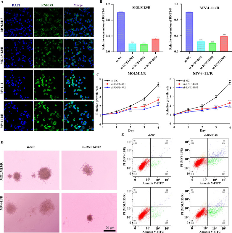 Spatiotemporal evolution of AML immune microenvironment remodeling and RNF149-driven drug ...