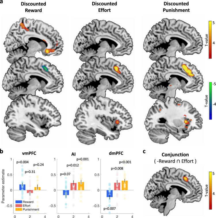 A neuro-computational account of procrastination behavior - PMC