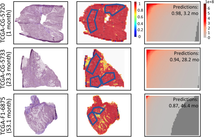 Deep learning-based framework for slide-based histopathological image analysis - PMC