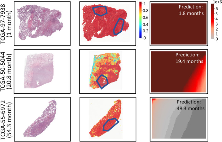 Deep learning-based framework for slide-based histopathological image analysis - PMC