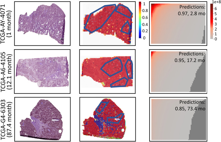 Deep learning-based framework for slide-based histopathological image analysis - PMC