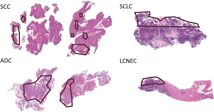 Deep learning-based framework for slide-based histopathological image analysis - PMC