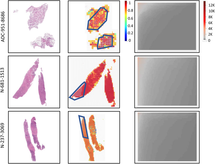 Deep learning-based framework for slide-based histopathological image analysis - PMC