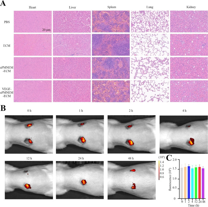 An injectable, activated neutrophil-derived exosome mimetics/extracellular matrix hybrid ...