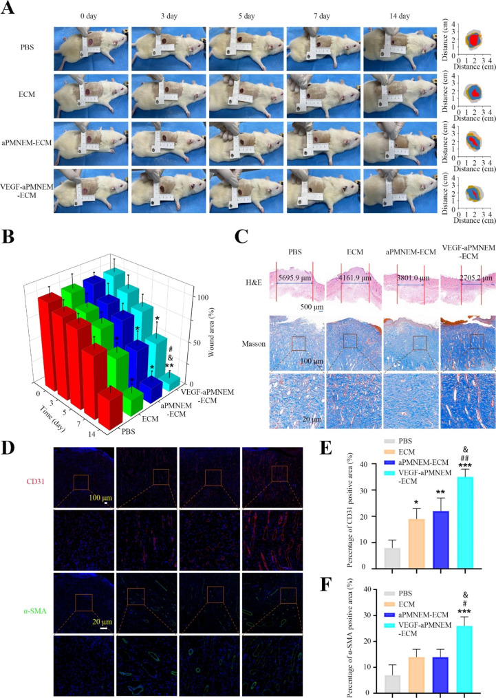 An injectable, activated neutrophil-derived exosome mimetics/extracellular matrix hybrid ...