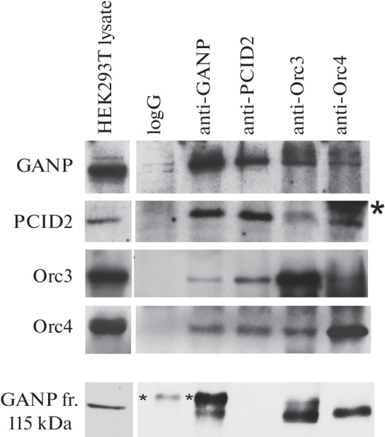 The Human TREX-2 Complex Interacts with Subunits of the ORC Complex - PMC