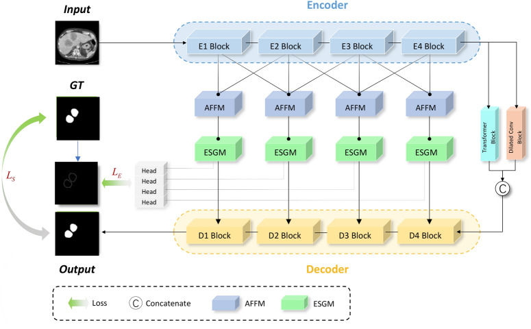 Edge-guided multi-scale adaptive feature fusion network for liver tumor segmentation - PMC