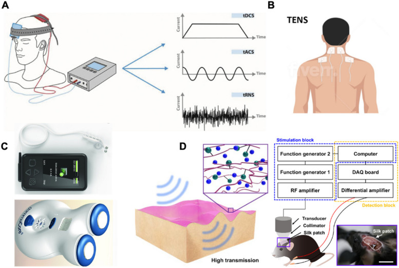 Hydrogels in wearable neural interfaces - PMC