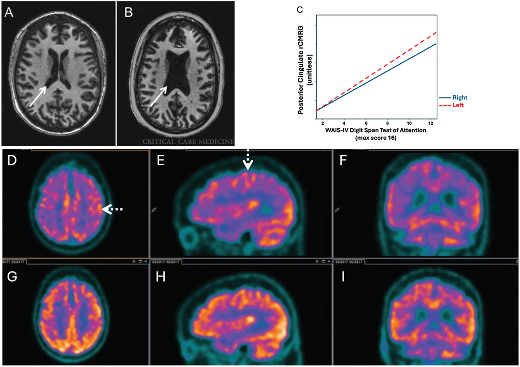 The Pathophysiology and Biomarkers of Delirium - PMC