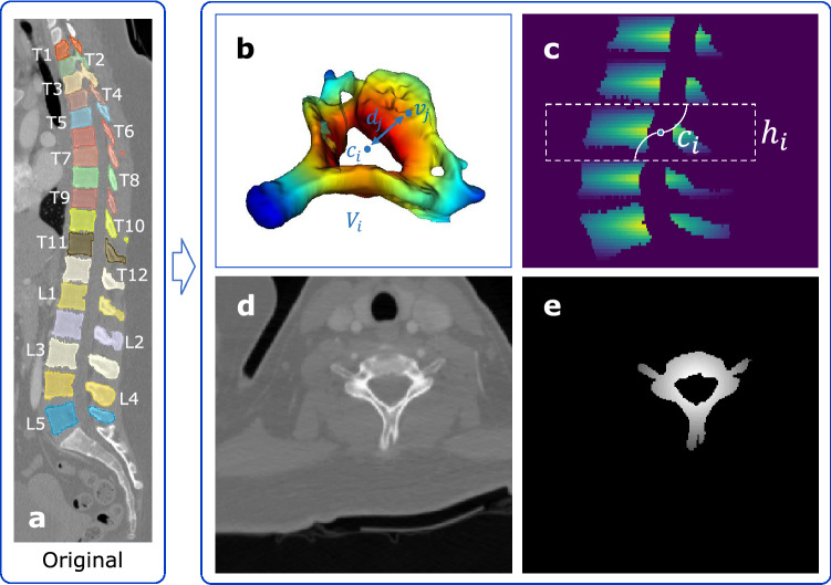 Automatic vertebrae localization and segmentation in CT with a two-stage Dense-U-Net - PMC