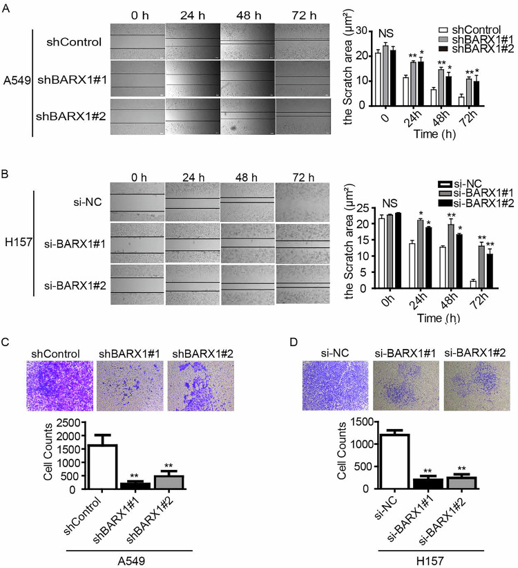 Correction: ZFP36 loss-mediated BARX1 stabilization promotes malignant ...