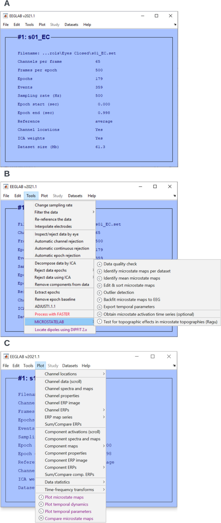 MICROSTATELAB: The EEGLAB Toolbox for Resting-State Microstate Analysis - PMC