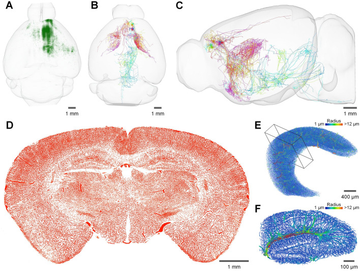Whole-brain Optical Imaging: A Powerful Tool for Precise Brain Mapping at the Mesoscopic Level - PMC