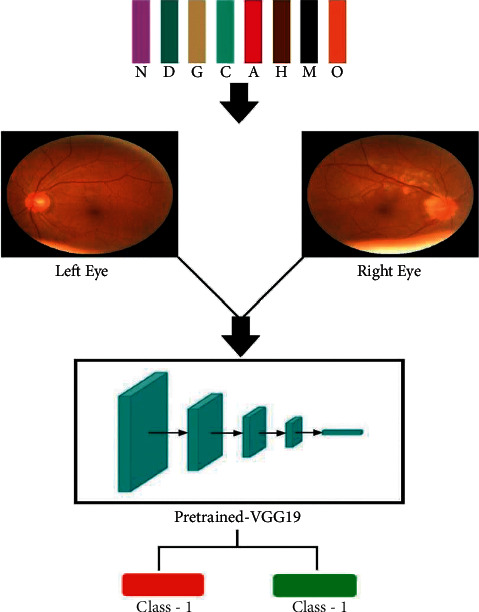Deep Learning for Ocular Disease Recognition: An Inner-Class Balance - PMC Deep Learning for Ocular Disease Recognition: An Inner-Class Balance - PMC