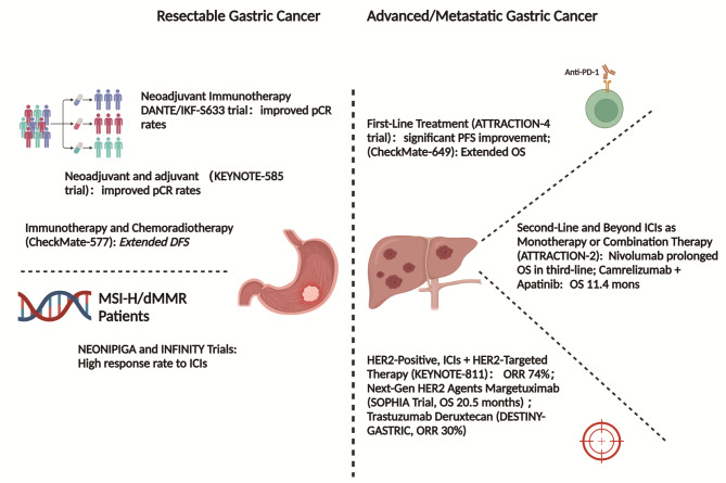 Applications and challenges of immunotherapy in the management of gastric adenocarcinoma ...