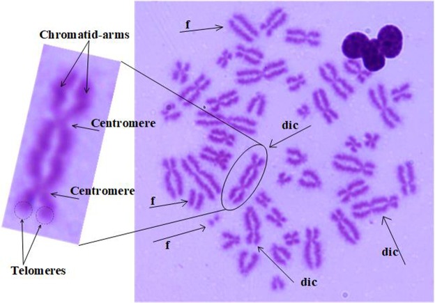 A dicentric chromosome identification method based on clustering and watershed algorithm - PMC