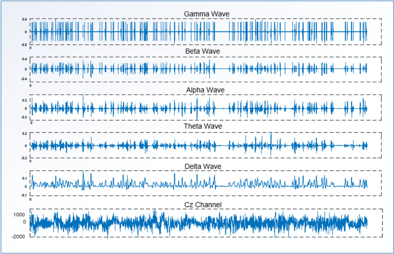 Quantum Machine-Based Decision Support System for the Detection of Schizophrenia from EEG ...